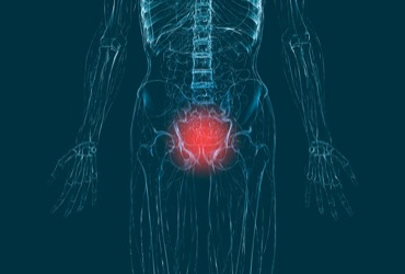 Getting to the Source of Chronic Groin Pain