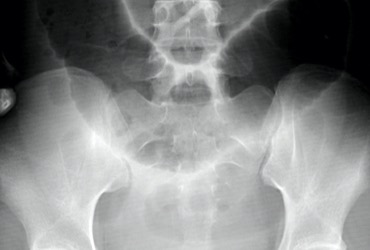 SBO Patients Fare Better With Surgical Services, Even Those Managed ...