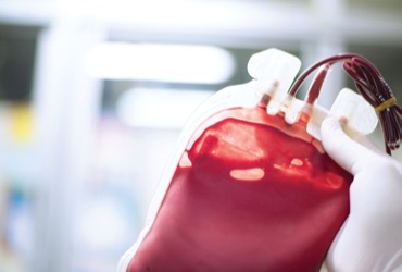 Surgical Blood Product Ordering: A Data-Driven Approach