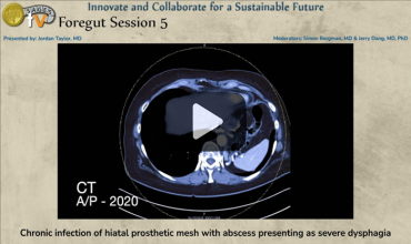 Chronic infection hiatal prosthetic mesh abscess severe dysphagia