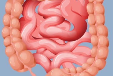 Colorectal Surgery On the Spot