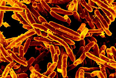 M abscessus Heater-Cooler Devices Infections